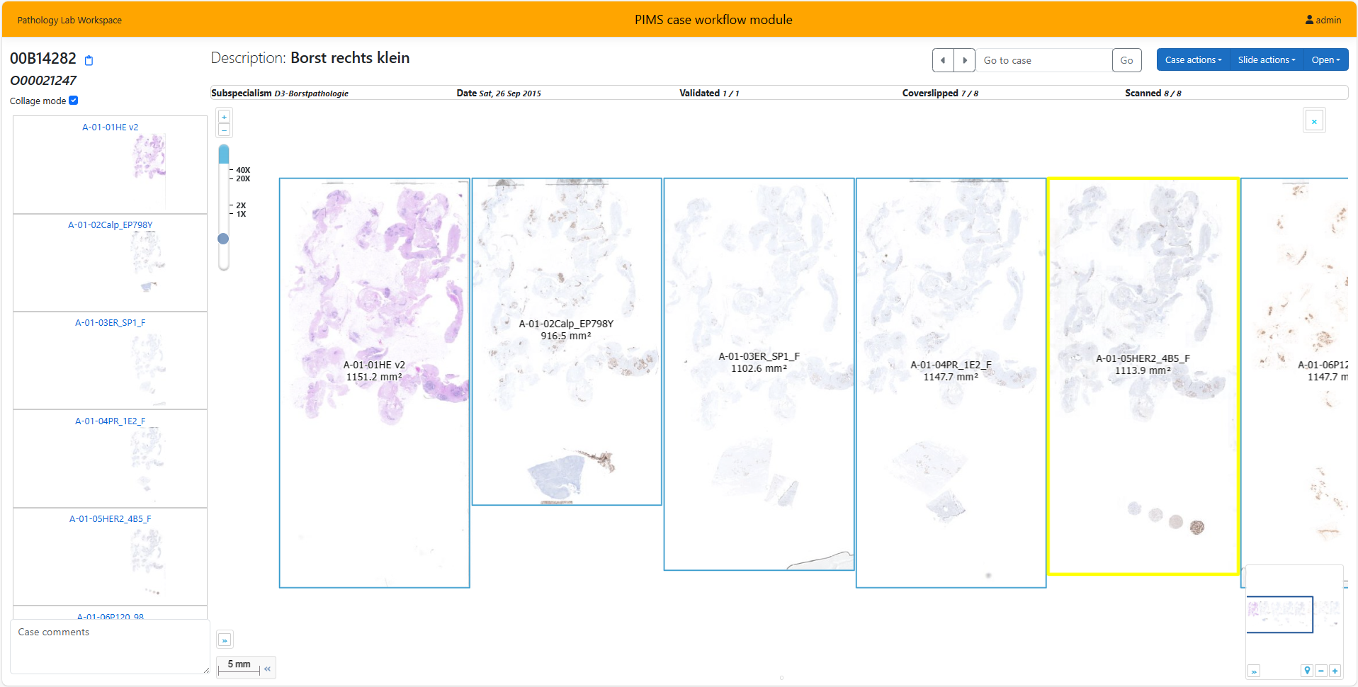 PIMSDX - Pathomation